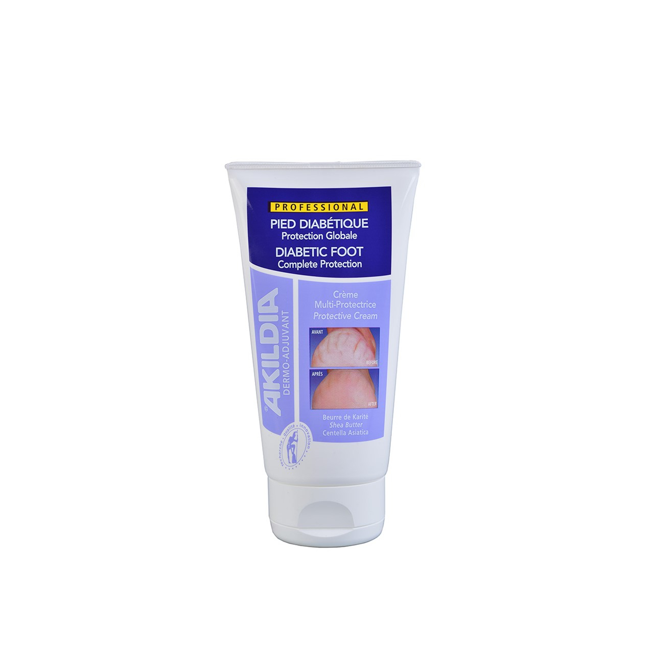 Akildia Diabetic Foot Protective Cream Saudi Arabia