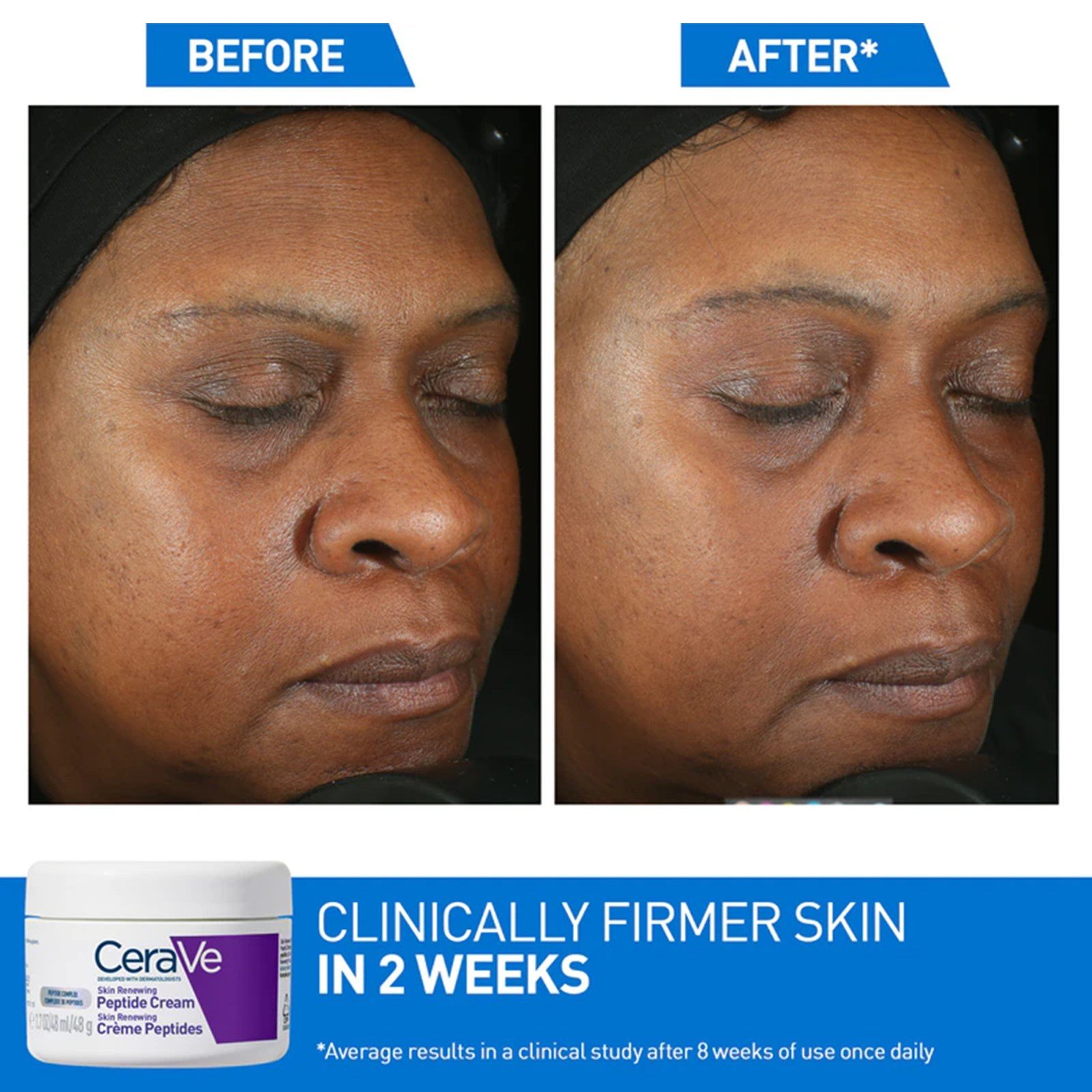 CeraVe Skin Renewing Peptide Cream 48g (1.7oz) USA