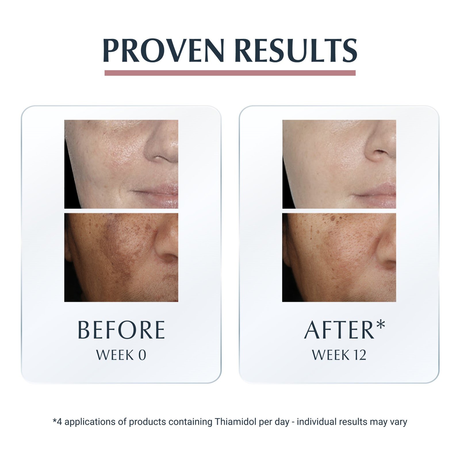 Eucerin Anti-Pigment Spot Corrector Dark Spots 5ml USA