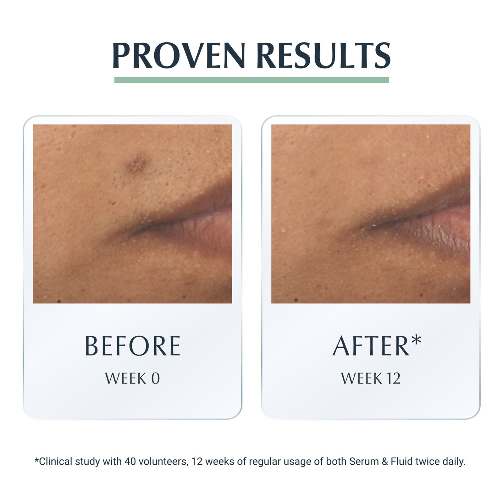 Eucerin DERMOPURE Oil Control Triple Effect Serum 40ml (1.35floz) USA