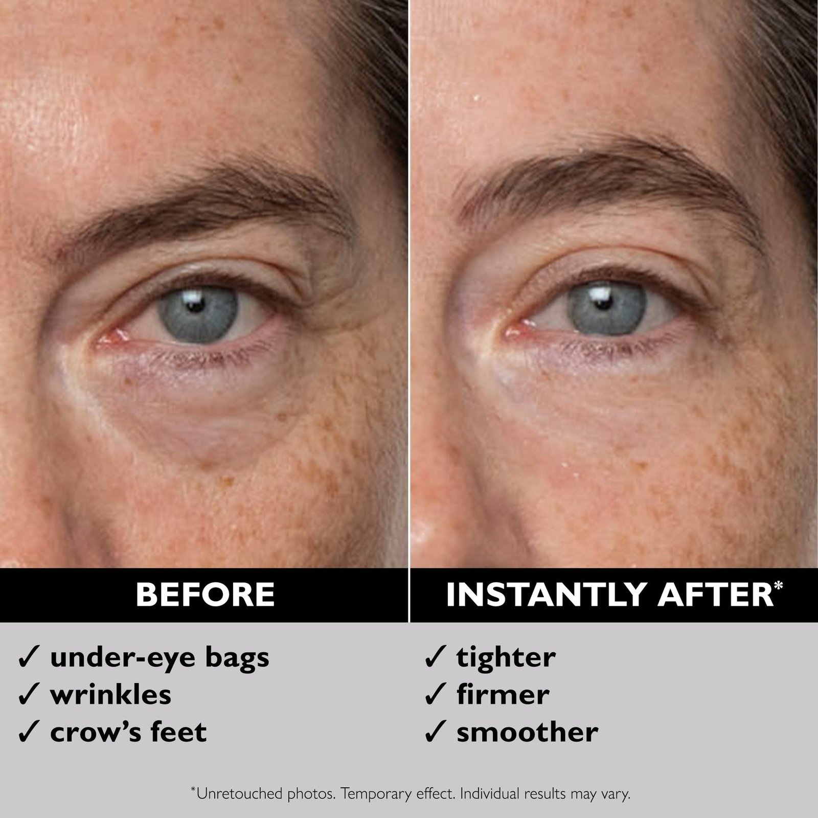Peter Thomas Roth Instant FIRMx Eye Temporary Eye Tightener 30ml South ...